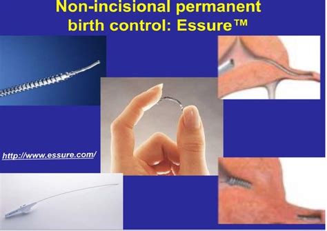 Human Sexuality Unit Study Guide Flashcards Quizlet