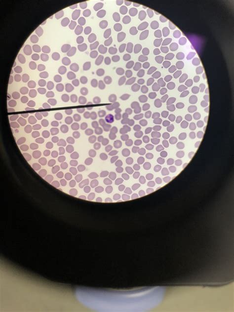 Lab Final Practice Question Diagram Quizlet