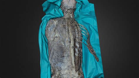 Paraspinal Muscles 3d Atlas Of Neurological Surgery