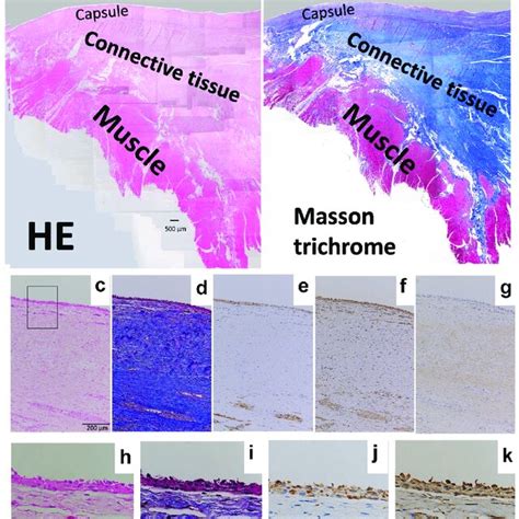 Histology Of Wide Resection With Mesh A Micrograph Of Download