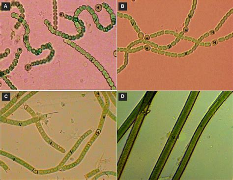 Nostoc Heterocyst Nostoc Amination Nostoc Blue Green Algae Nostoc