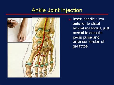 High Impact Rheumatology Joint Examination And Injection Techniques