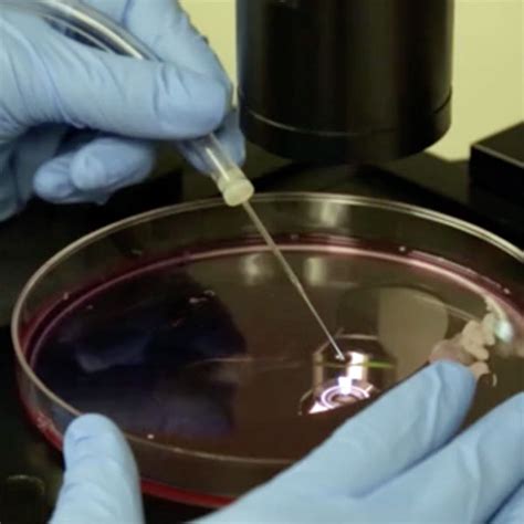 Detection Of Copy Number Alterations Using Single Cell Sequencing