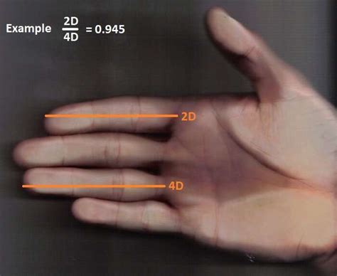 2d 4d Ratio Is Not Related To Sex Determined Finger Size Differences In