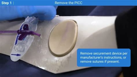 Picc Line Removal Techniques Tips And Troubleshooting Medbridge