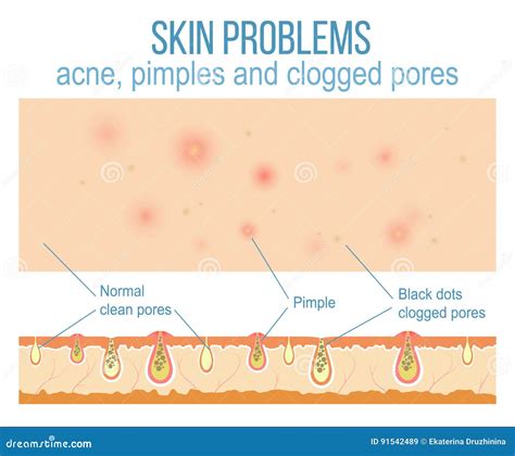 Skin And Pores Stock Vector Illustration Of Reduce Layer 91542489