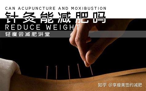 针灸能减肥吗针灸减肥会反弹吗 知乎