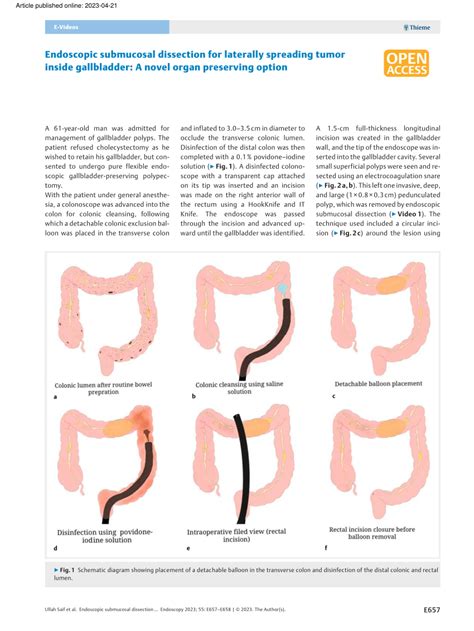 Pdf Endoscopic Submucosal Dissection For Laterally Spreading Tumor Inside Gallbladder A Novel