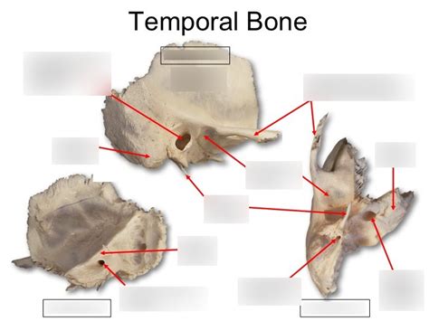 Temporal Bone Diagram Quizlet