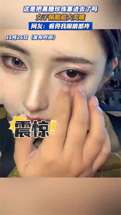 女子佩戴超大美瞳 网友：看得我眼睛都疼 腾讯新闻