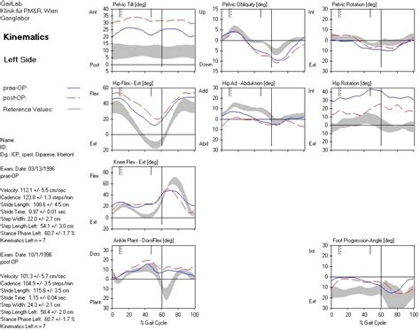 Clinical Gait Analysis