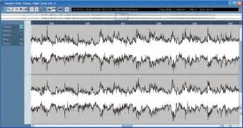 The SOS Guide To Mix Compression