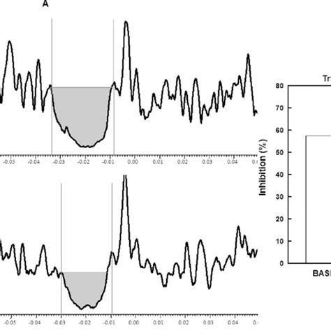 Temporal Interference For Noninvasive Electrical Stimulation Of Deep Download Scientific