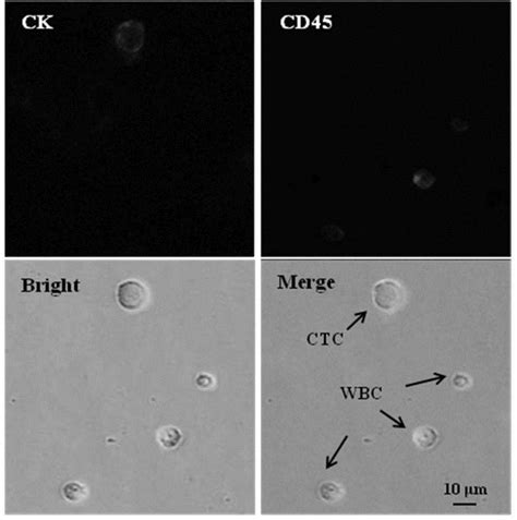 Simple Single Circulating Tumor Cell Separation Method And Apparatus Eureka Patsnap