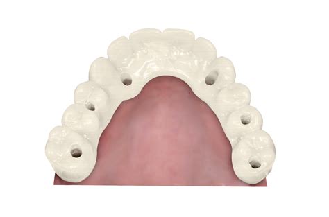 Firstplug Barrier Plugger Instrument Emerald Dental Works