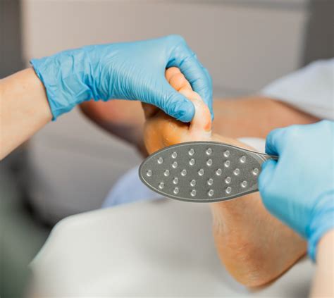 Ballerina Feet Most Common Foot Problems