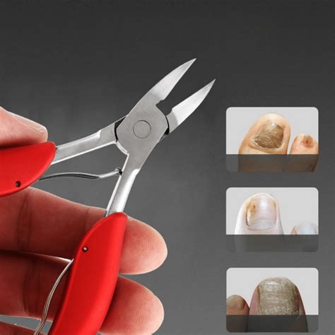 Fifth Generation Paronychia Nippers Large Toenail Clippers For Ingrown Toenails And Hangnails