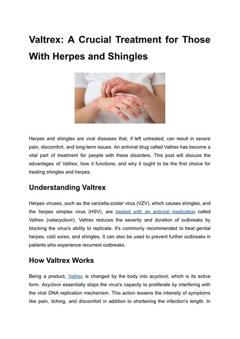 Ppt Pdf Valtrex A Crucial Treatment For Those With Herpes And