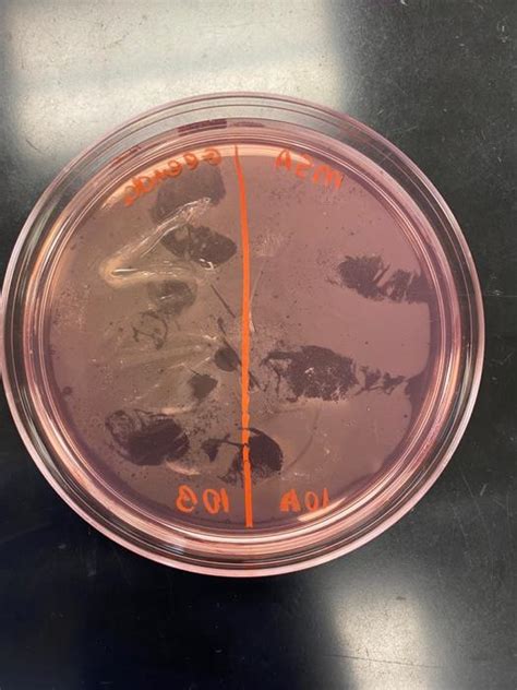 Solved On This Plate Msa 10a Is Bacillus Cereus And 10b