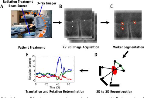 Figure 1 From Six Degrees Of Freedom Prostate And Lung Tumor Motion