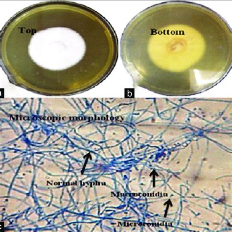 Macroscopy And Microscopy Of Trichophyton Rubrum Growing On Sabouraud