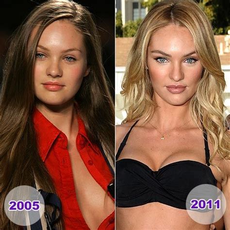 Candice Swanepoel Before She Was Famous