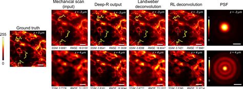 Figure 1 From Single Shot Autofocusing Of Microscopy Images Using Deep
