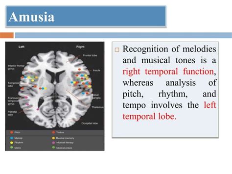 Higher Cortical Functions Final Pptx
