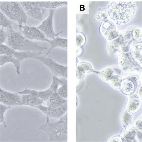 Cytopathic Effect In Hek293 Cells The Left Picture Shows The Normal