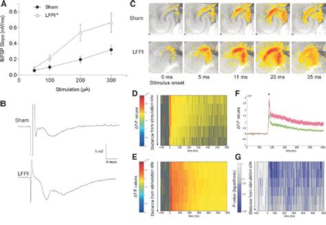 Figure 1 From Diminished Dentate Gyrus Filtering Of Cortical Input