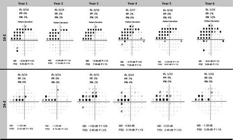 Functional Assessment Of Glaucoma Uncovering Progression Survey Of