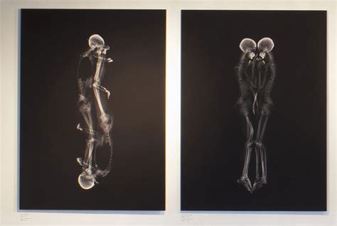 Intimate X Ray Portraits Of Couples By Ayako Kanda And Mayuka Hayashi Bored Panda
