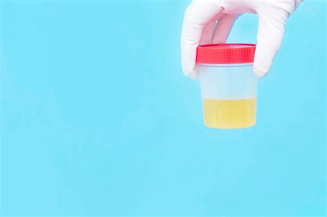 소변의 의료 분석 의사는 빨간 뚜껑이있는 항아리에 소변 검사를 손에 쥐고 있습니다 의료 및 의학 텍스트에 대한 장소 Mockup 건강관리와 의술에 대한 스톡 사진 및 기타