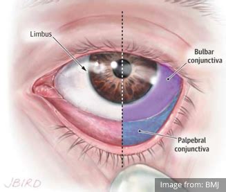 Anatomy Of Conjunctiva Eye Anatomy Glaucoma Research Foundation