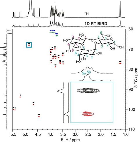 Comparison Between The Conventional Multiplicity Edited Hsqc Spectrum