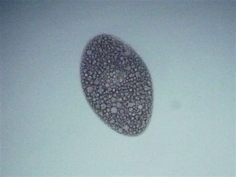 Order Opalinata · Inaturalist