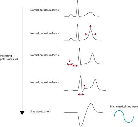 Pin On Cardio Renal Respiratory