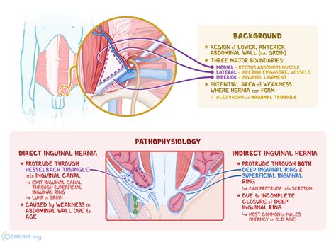 Superficial Inguinal Ring Superficial Inguinal Ring