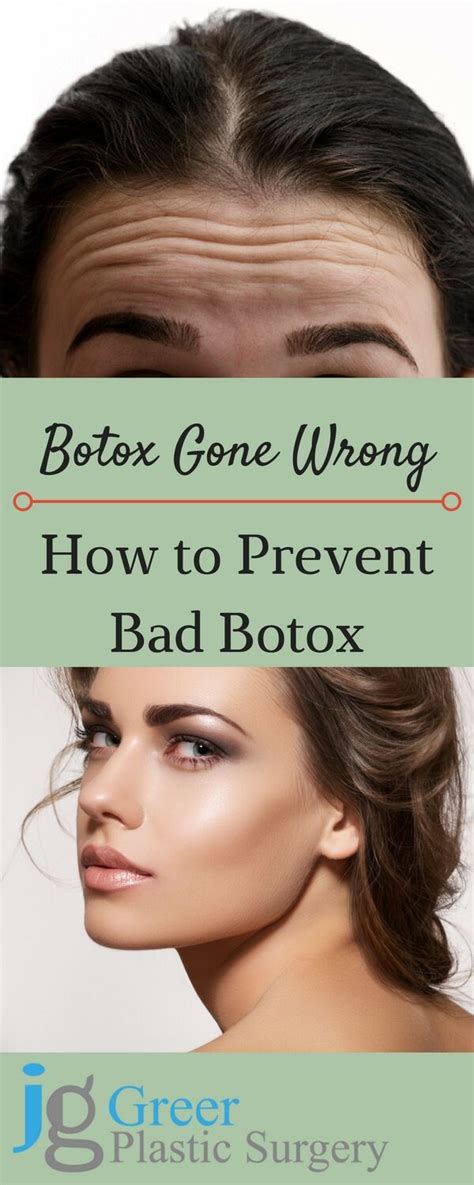 When Botox Gone Wrong Artofit When Botox Gone Wrong Artofit
