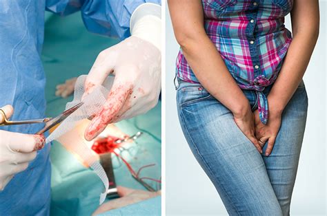 Women Claim This Surgery Has Cost Them Their Happiness Their Sex Lives And Hundreds Of