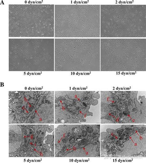 Mir 137 通过 Jnk Ap 1 信号通路调节低强度剪切应力诱导的人主动脉内皮细胞凋亡 知乎