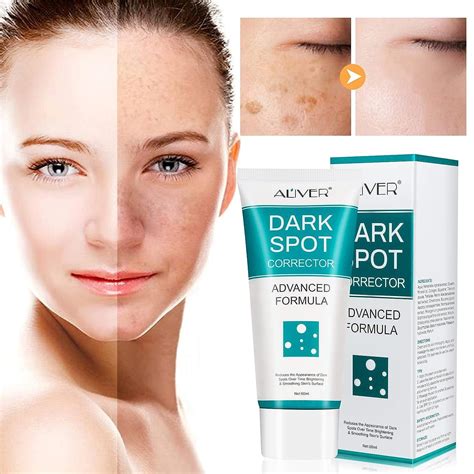 Dark Spot Corrector Cream For Face Fade Black Precipitates Remove