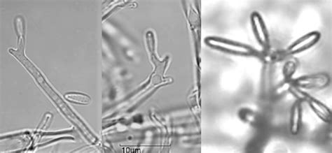 Morphological Characters Considered Fusahelp
