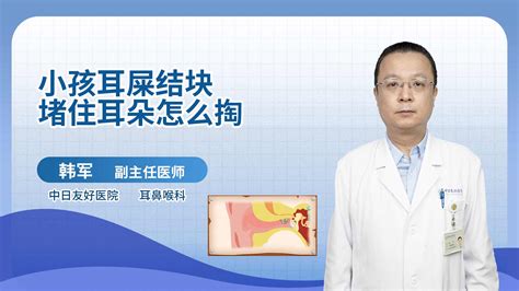 耵聍栓塞 耵聍栓塞的病因 耵聍栓塞有哪些临床表现