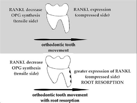 Pathological Root Resorption Download Scientific Diagram