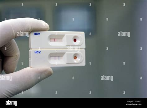 2 Rapid Test Results For Hepatitis C Virus A Negative And A Positive
