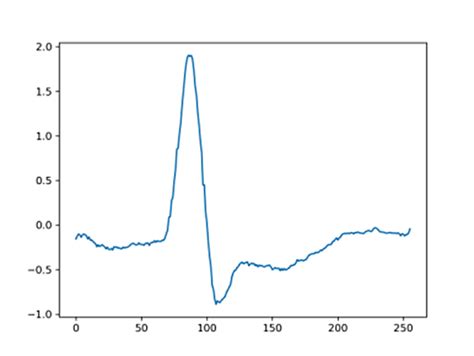 different types of original heartbeat samples and generated heartbeat