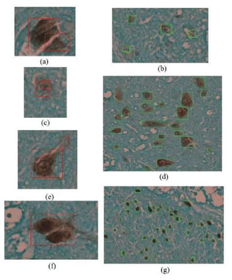 Examples Of The Neurons Detection Algorithm Results Excluding Manual