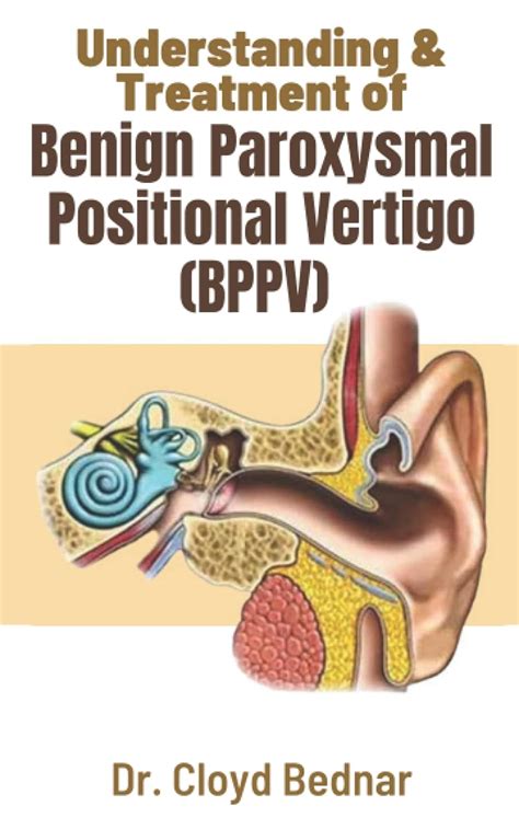 Benign Positional Vertigo Bppv Symptoms At Samuel Unwin Blog