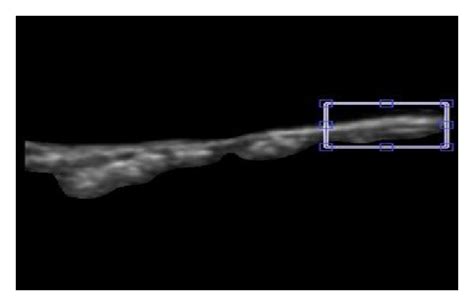 Manual Cropping Of A Region Of Interest Roi Marked By A Rectangle